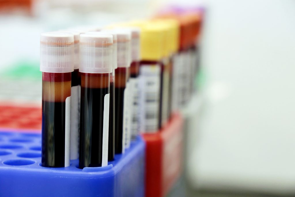 What Is a Bloodborne Pathogen? | Medical Waste Pros