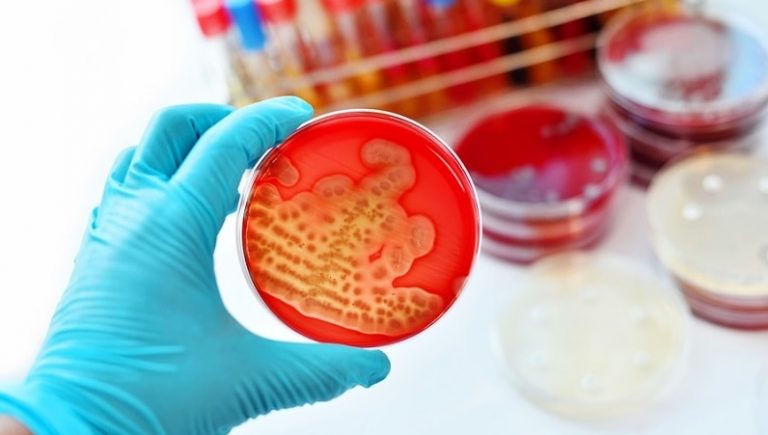 What Are OPIMs and How to Deal with Them | Medical Waste Pros